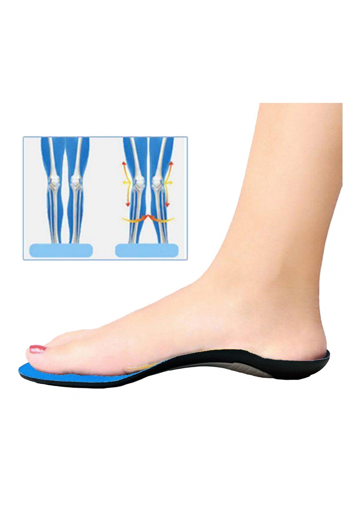 Yk Life YKLIFE Comfort System Ortopedik Taban SARI 201023479 | Flo